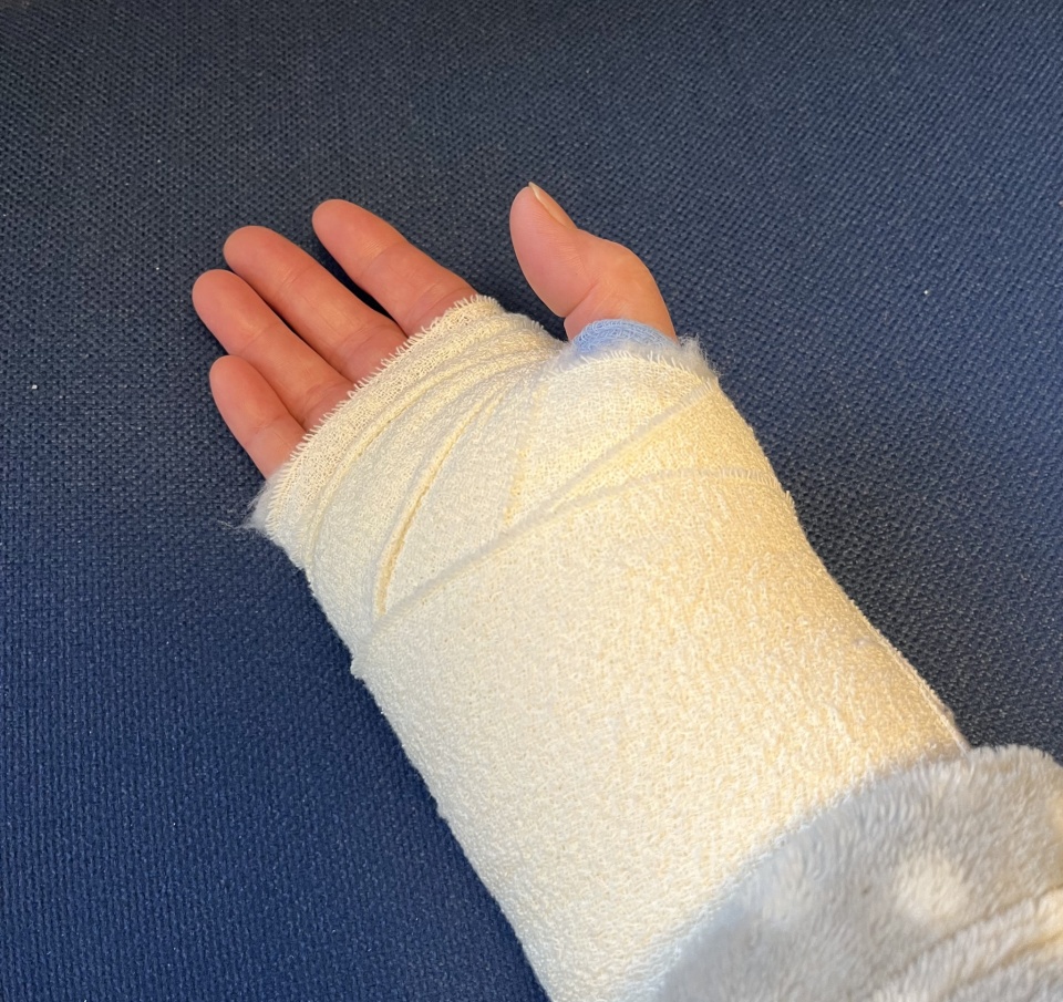 Carpal Tunnel Surgery | CherryR | Blipfoto