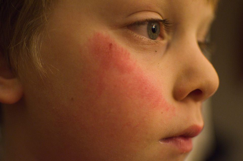 poor wee face | wingpig | Blipfoto