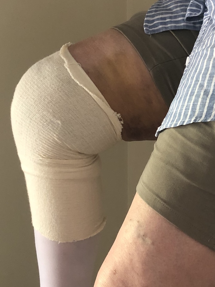 Bend zee knees | 59 | Blipfoto